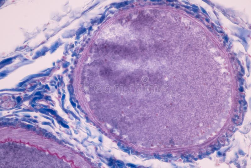 Ovary and Testis Human Cells Under Microscope. Stock Photo - Image of ...