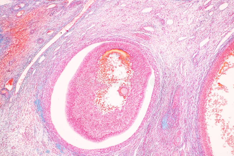 Sperm Cell Under Microscope Labeled