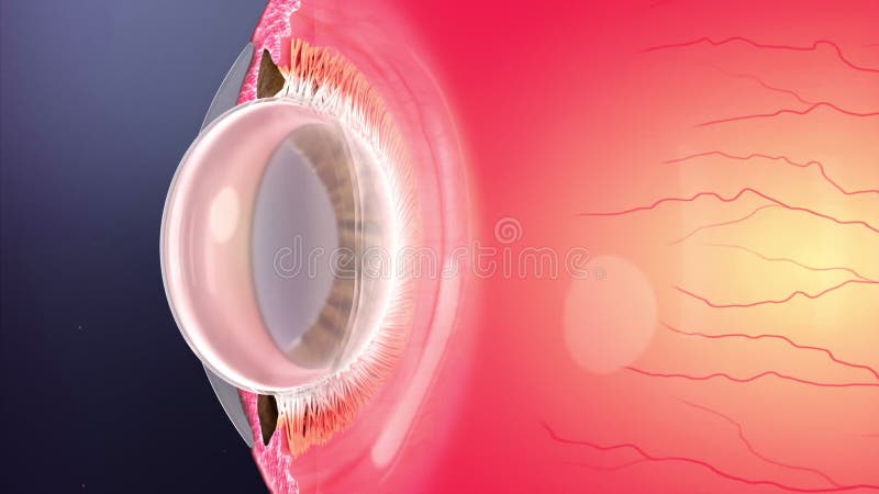 Anatomy of the Human Eye,ciliary Muscle Relaxation,Myopia Stock Video ...