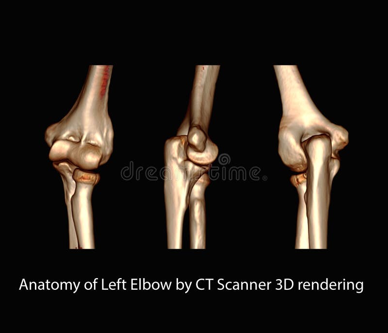 Anatomy Of Left Elbow By Ct Scanner 3d Rendering Image Stock Illustration Illustration Of