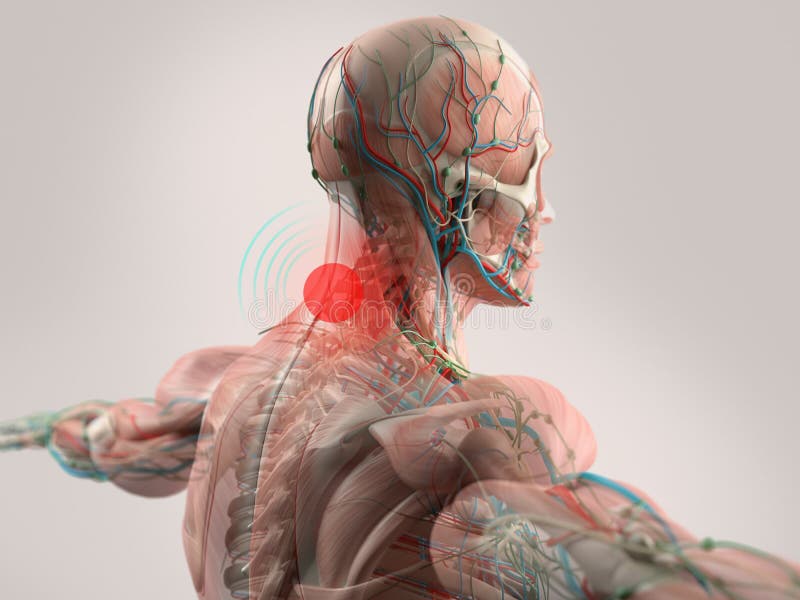 Anatomy Model Showing Neck Pain. Stock Illustration - Illustration of ...