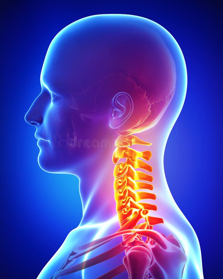 Anatomy of Pain in Neck of Female Stock Illustration - Illustration of ...