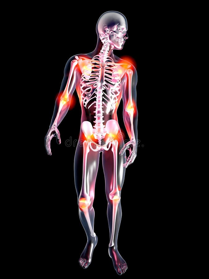 Anatomy - Painful Joints stock illustration. Illustration of disease ...