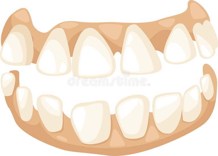 Anatomy Teeth Vector Stock Illustrations – 10,351 Anatomy Teeth Vector ...