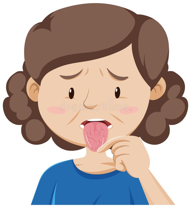 Personaje De Caricatura Con Síntomas De Boca Seca Ilustración del ...