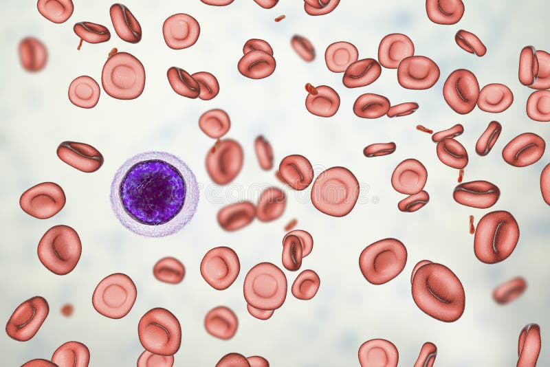 Anemia Foto Stock - Download 2,827 Royalty Free Photos