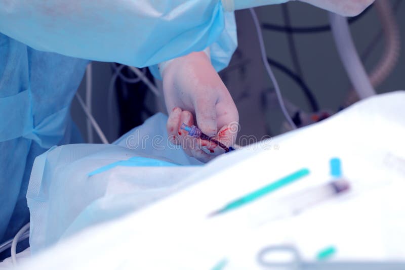 Anesthesiologist at work stock image. Image of anesthetist - 29173819