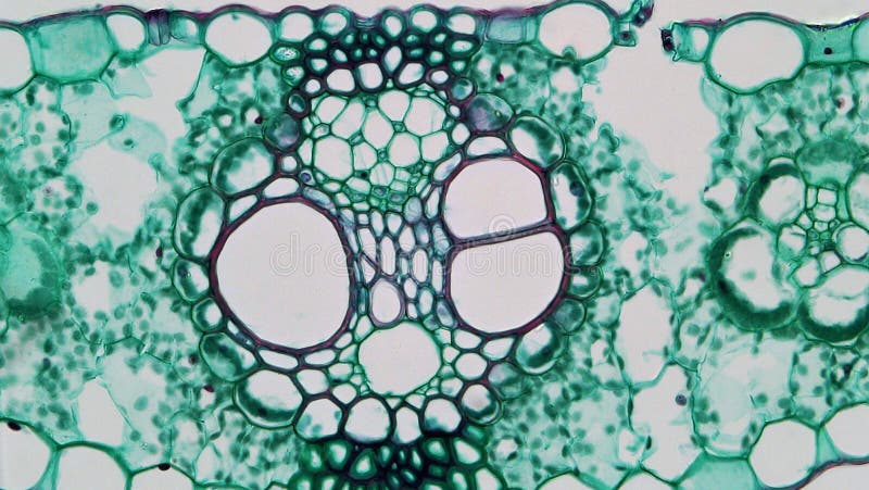 Angiosperm Morphology: The Closed And Collateral Vascular Bundle In Zea ...