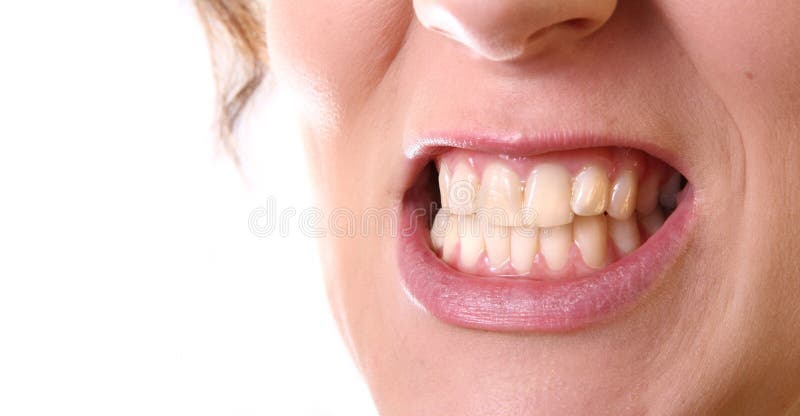 Angrrrry stock image. Image of expressive, anger, female - 3566585