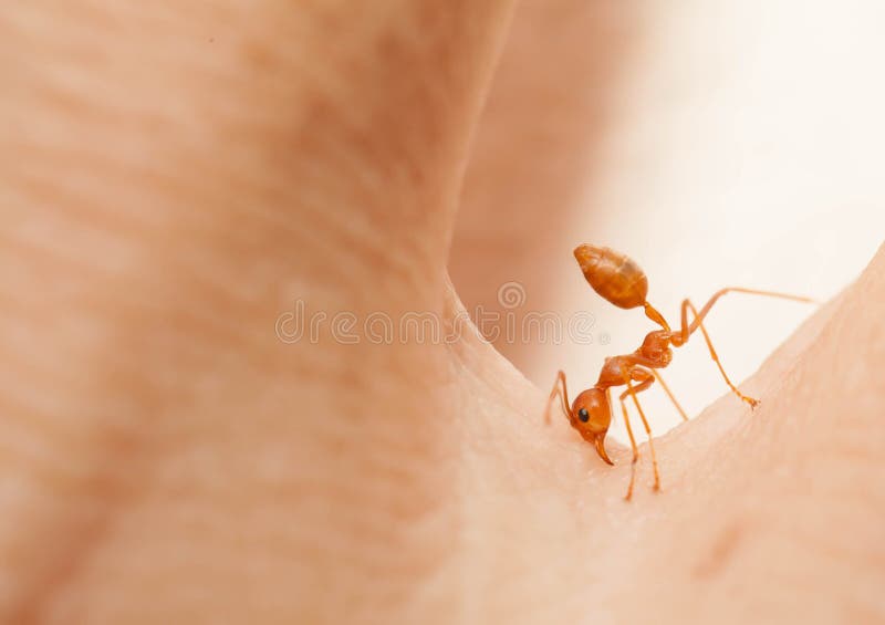 Angry Ant Attack by Bite and Spray Citric Acid Stock Photo - Image of ...