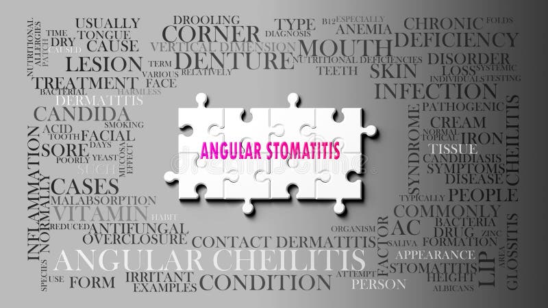 Angular Gyrus Stock Photos - Free & Royalty-Free Stock Photos from ...