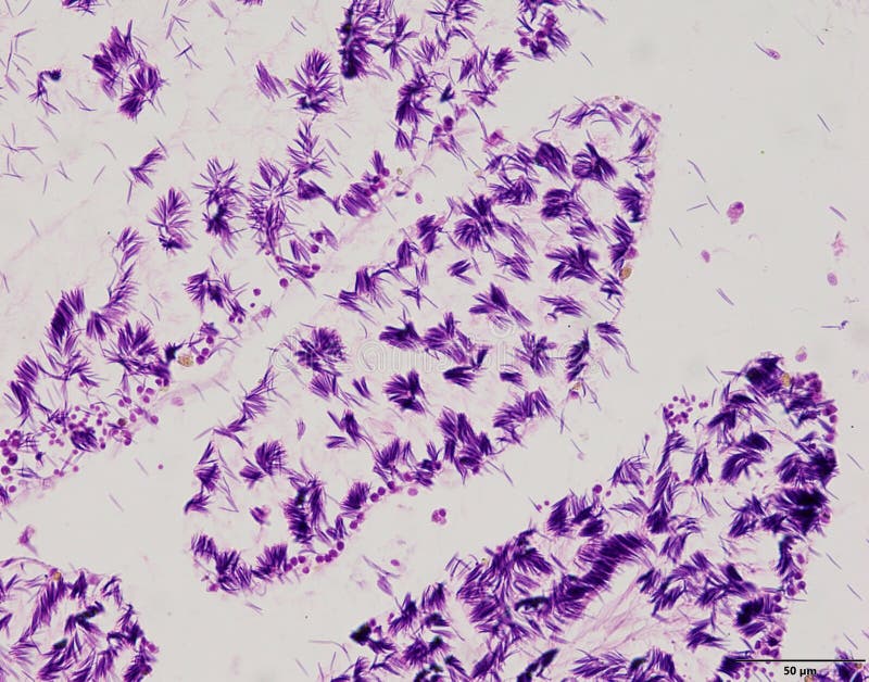 Animal Tissue Samples Under the Microscope. Stock Photo - Image of ...