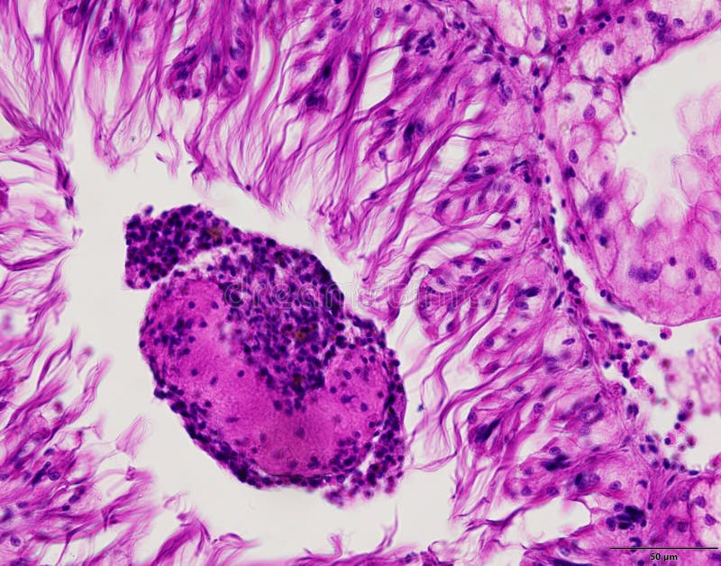 Animal Tissue Samples Under the Microscope. Stock Image - Image of ...