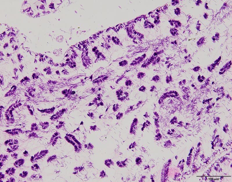 Animal Tissue Samples Under the Microscope. Stock Image - Image of ...