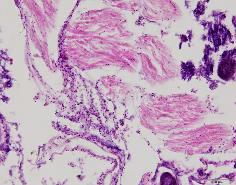 Animal Tissue Samples Under the Microscope. Stock Photo - Image of ...