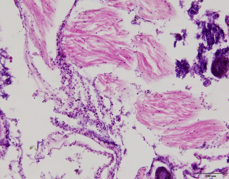 274 Simple Squamous Epithelium Under Microscope Drawing Stock Photos ...