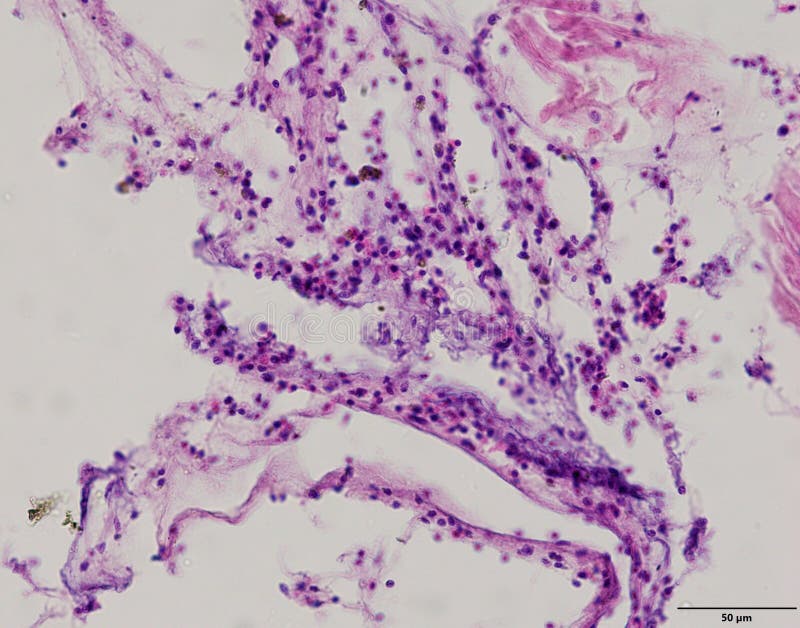 Animal Tissue Samples Under the Microscope. Stock Photo - Image of ...