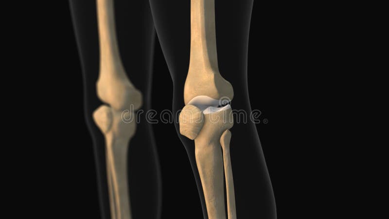 Medical Animation of the Patella Bone Pain Stock Illustration ...