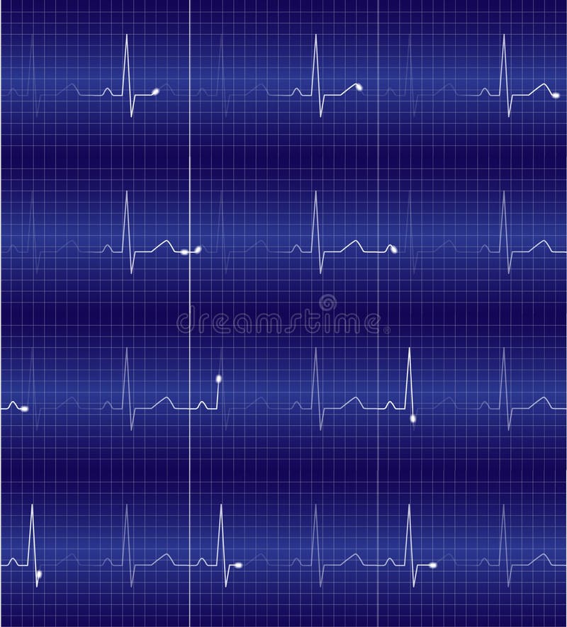 Animation Frame Heart Rate Screen Vector Illustration 2 Stock Vector ...