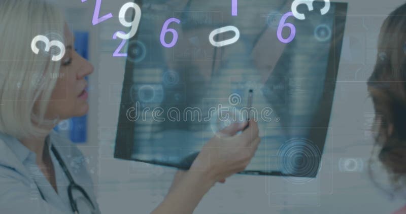 Animation of Numbers Changing and Scopes on Screens Over Female Doctor ...