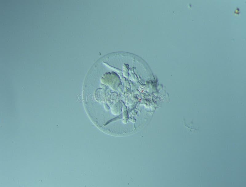 Animaux Rotatives Sous Le Microscope Photo stock - Image du jeune ...