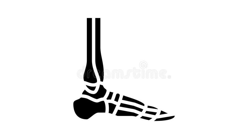 Femur Bone Glyph Icon Animation Stock Footage - Video of elbow ...