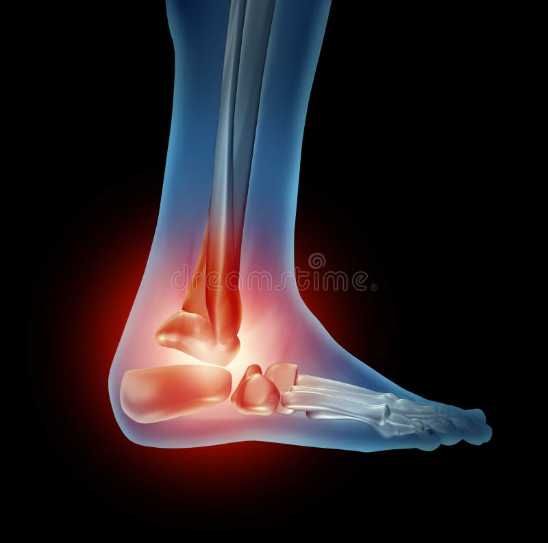 Ankle Foot Pain stock illustration. Illustration of care - 23812152