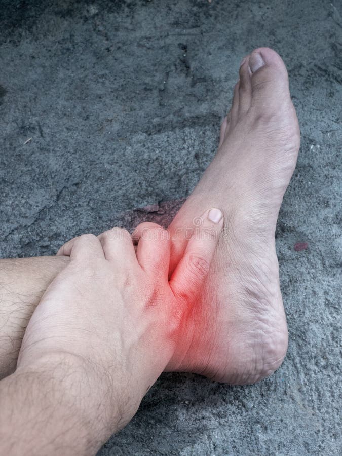 Ankle injury. stock photo. Image of care, injured, painful - 106457542