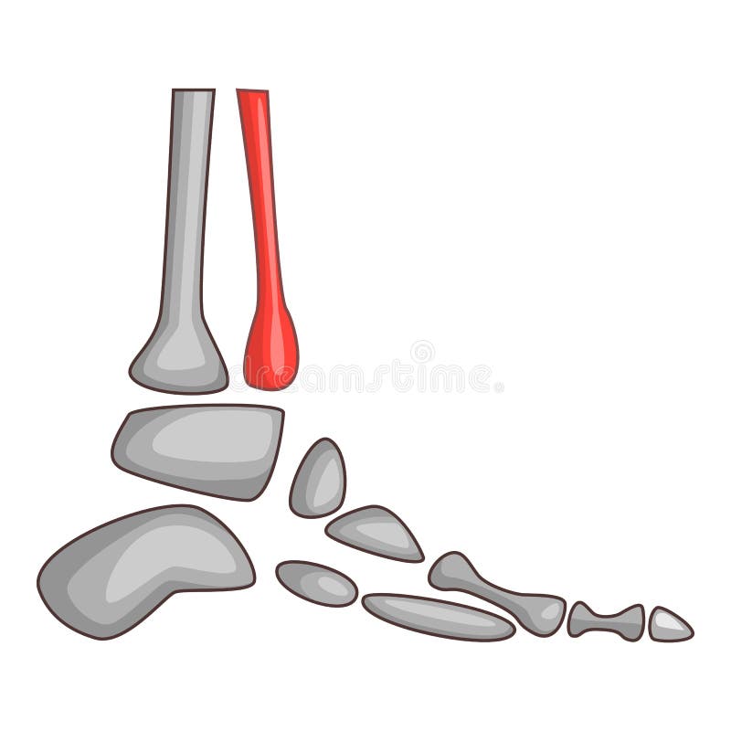 Ankle Pain Icon, Cartoon Style Stock Vector - Illustration of ankle ...