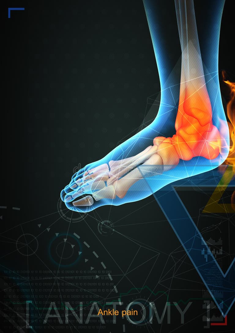 Ankle Pain Stock Illustrations – 7,168 Ankle Pain Stock Illustrations ...