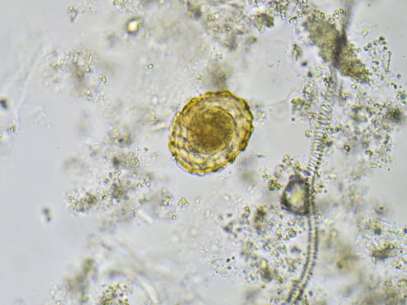 Ankylostome Dans Les Selles Photo stock - Image du micro, maladie ...