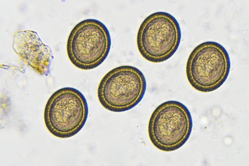 Ankylostome Dans Les Selles Photo stock - Image du micro, maladie ...