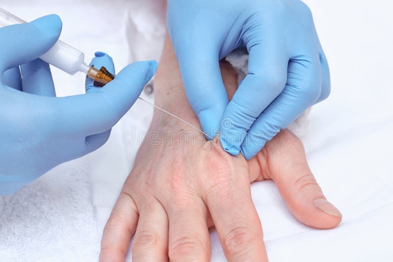 Anti-age Injection Therapy. Hand Rejuvenation. Stock Image - Image of ...