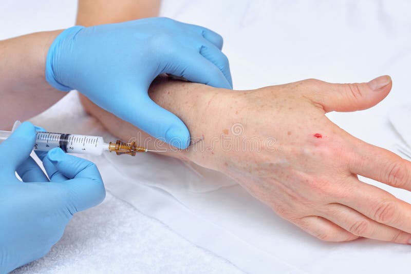 Anti-age Injection Therapy. Hand Rejuvenation. Stock Image - Image of ...