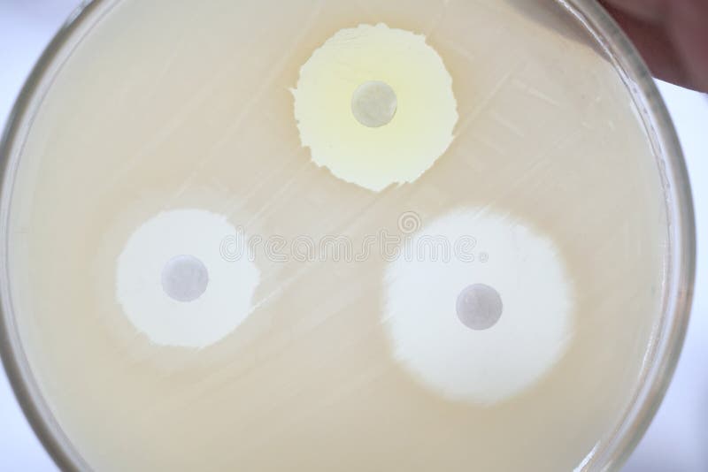 Antibiotic Sensitivity of Bacteria by Means of Diffusion Test is Stock ...