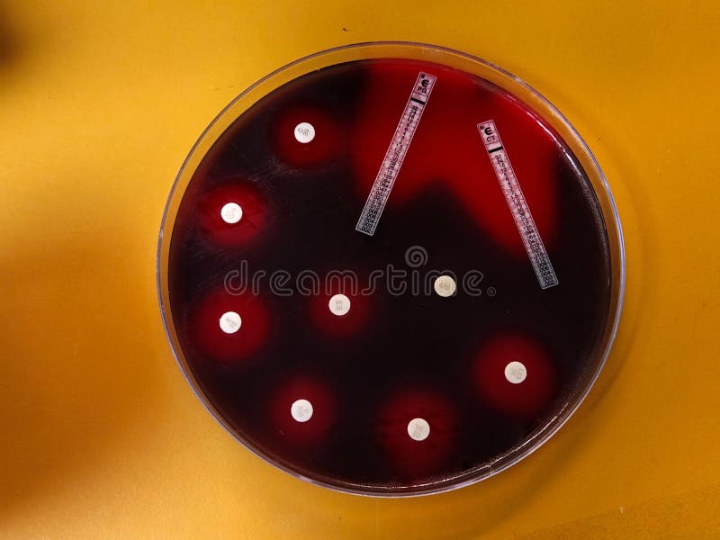 Antibiotic Susceptibility Testing - Agar Plate with Discs and E-Test ...