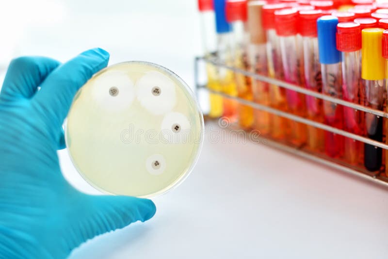 Antimicrobial Susceptibility Test Stock Photo - Image of experiment ...
