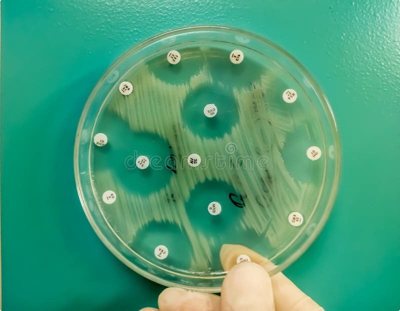 Antimicrobial Susceptibility Testing in Culture Plate. Drug Sensitivity ...