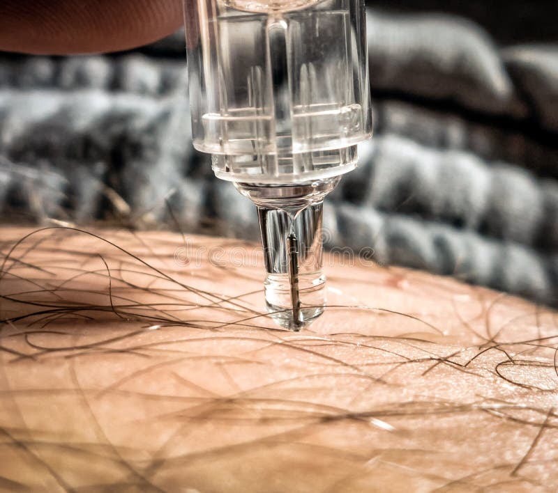 Medicament Antithrombotic Injection Stock Photo - Image of medical ...