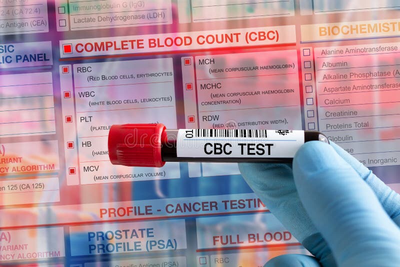 Análisis De Tubo Sanguíneo Con El Formulario De Solicitud Para La ... Análisis De Tubo Sanguíneo Con El Formulario De Solicitud Para La ...