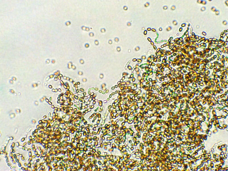 Aphanothece Sp. Algae Under Microscopic View, Cyanobacteria Stock Photo ...