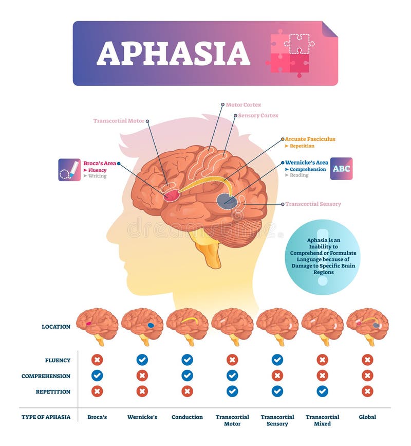 Aphasia. Human Brain with Damage To Specific Areas Stock Vector ...