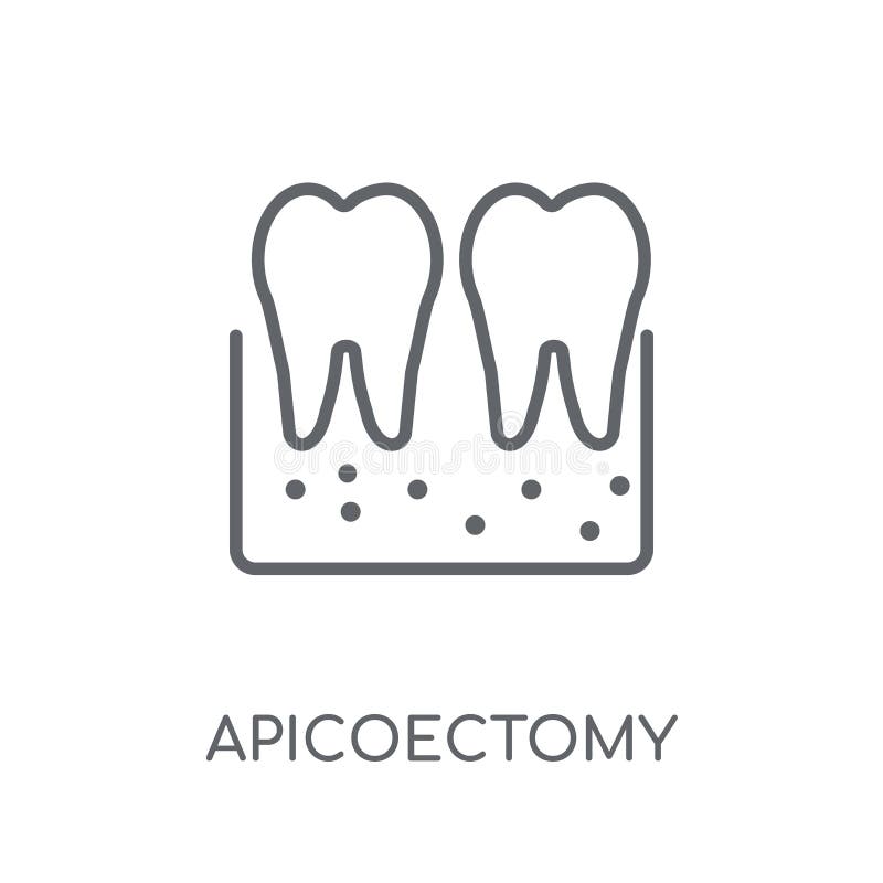 Apicoectomy Stock Illustrations – 40 Apicoectomy Stock Illustrations ...