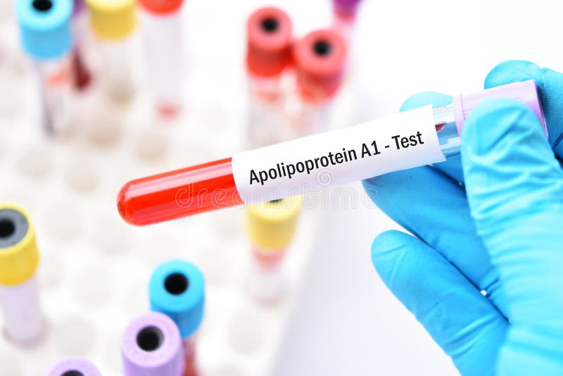 Apolipoprotein a test stock image. Image of care, apob - 132938143