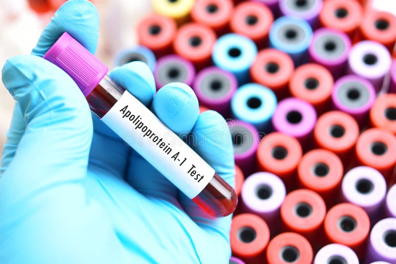 Apolipoprotein a test stock image. Image of care, apob - 132938143