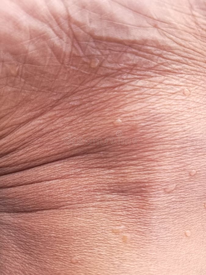 Appearance of Human Skin Human Fit Natural Stock Photo - Image of human ...