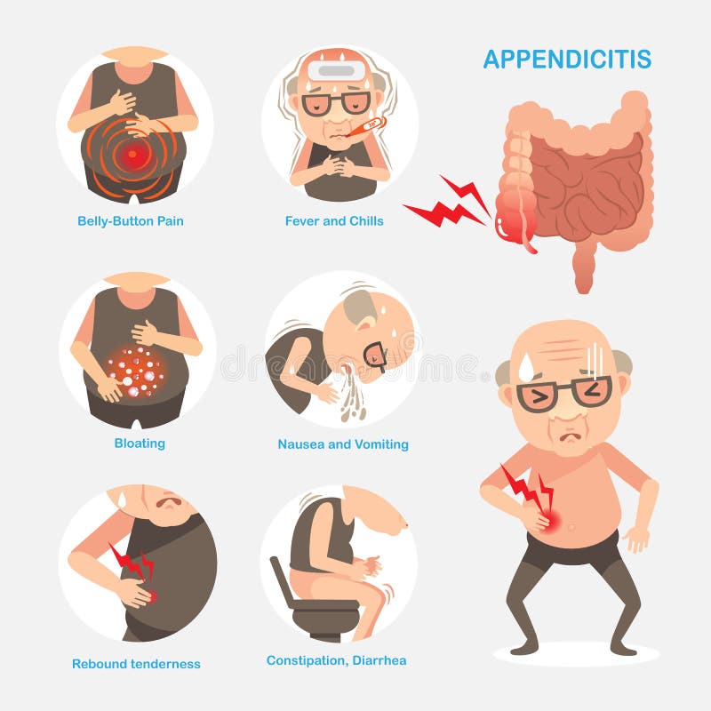 Appendicitis ilustração do vetor. Ilustração de abdominal - 83855653
