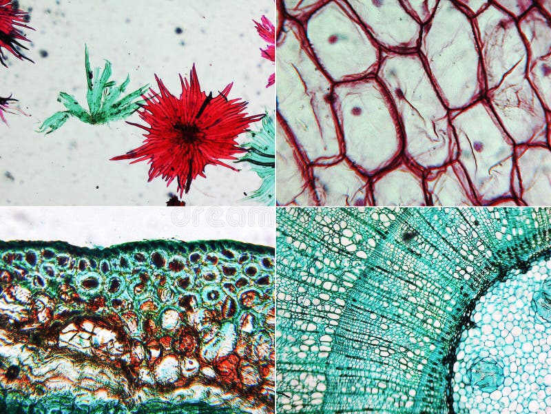 Apple, Onion and Pine Wood Micrograph Stock Image - Image of scientific ...