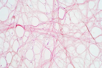 Reticular Tissue Stock Photos - Free & Royalty-Free Stock Photos from ...