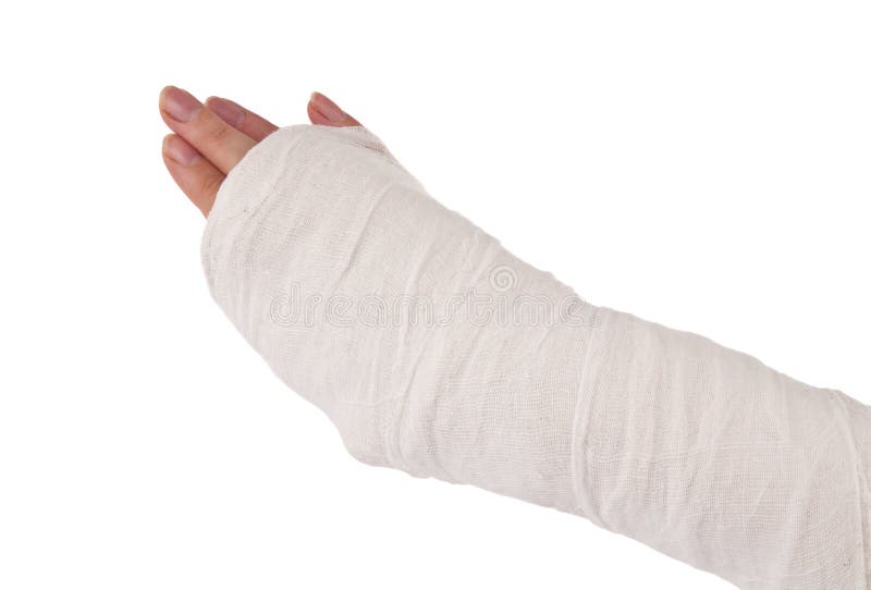 Arm in a cast stock image. Image of wrist, injury, health - 27103509